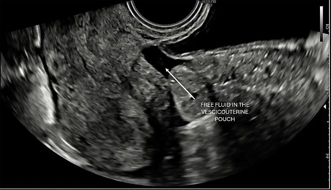Ultrasound Assessment of Pelvic Anatomy | Article | GLOWM